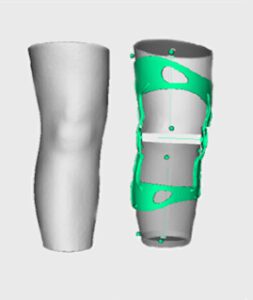 Evoke™ 3D Printed Custom Knee Brace - Osteoarthritis | Osskin